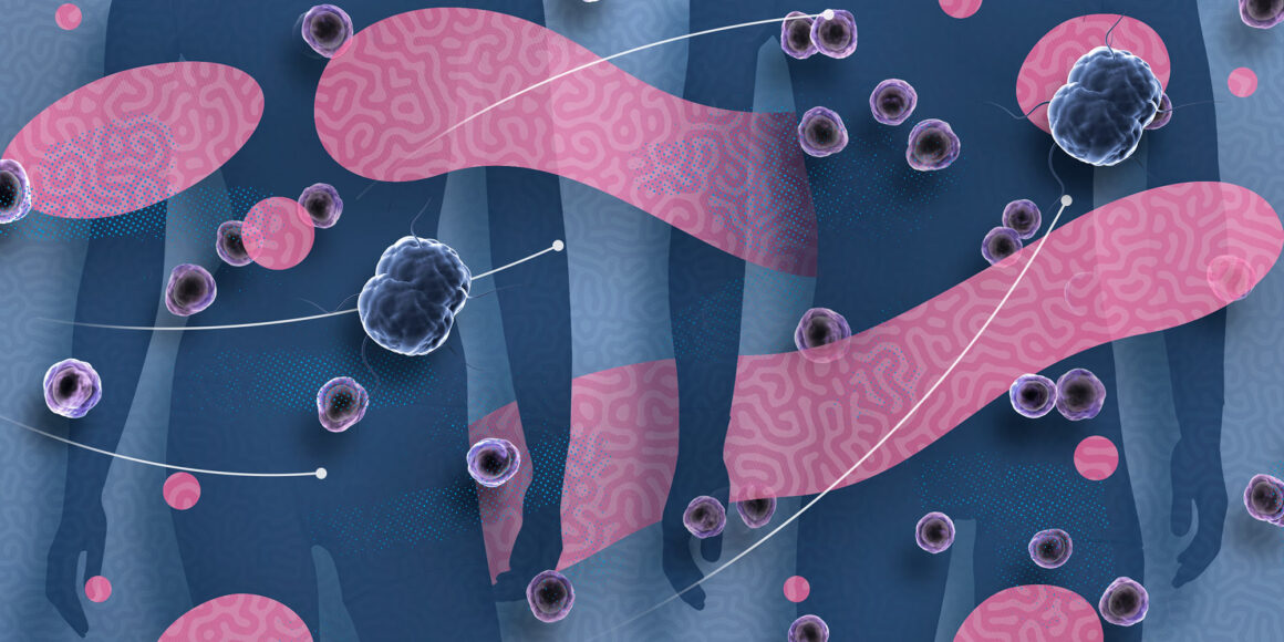 Understanding the Most Common STI: Chlamydia - Up Campus